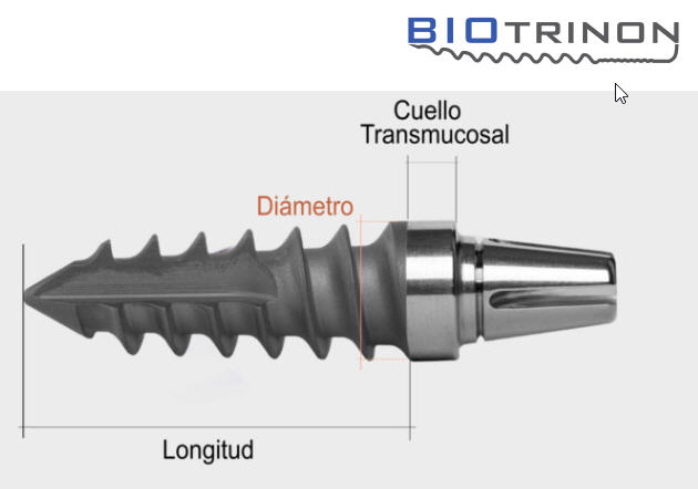 IMPLANTES :: CLINICA DENTAL ESTRADA